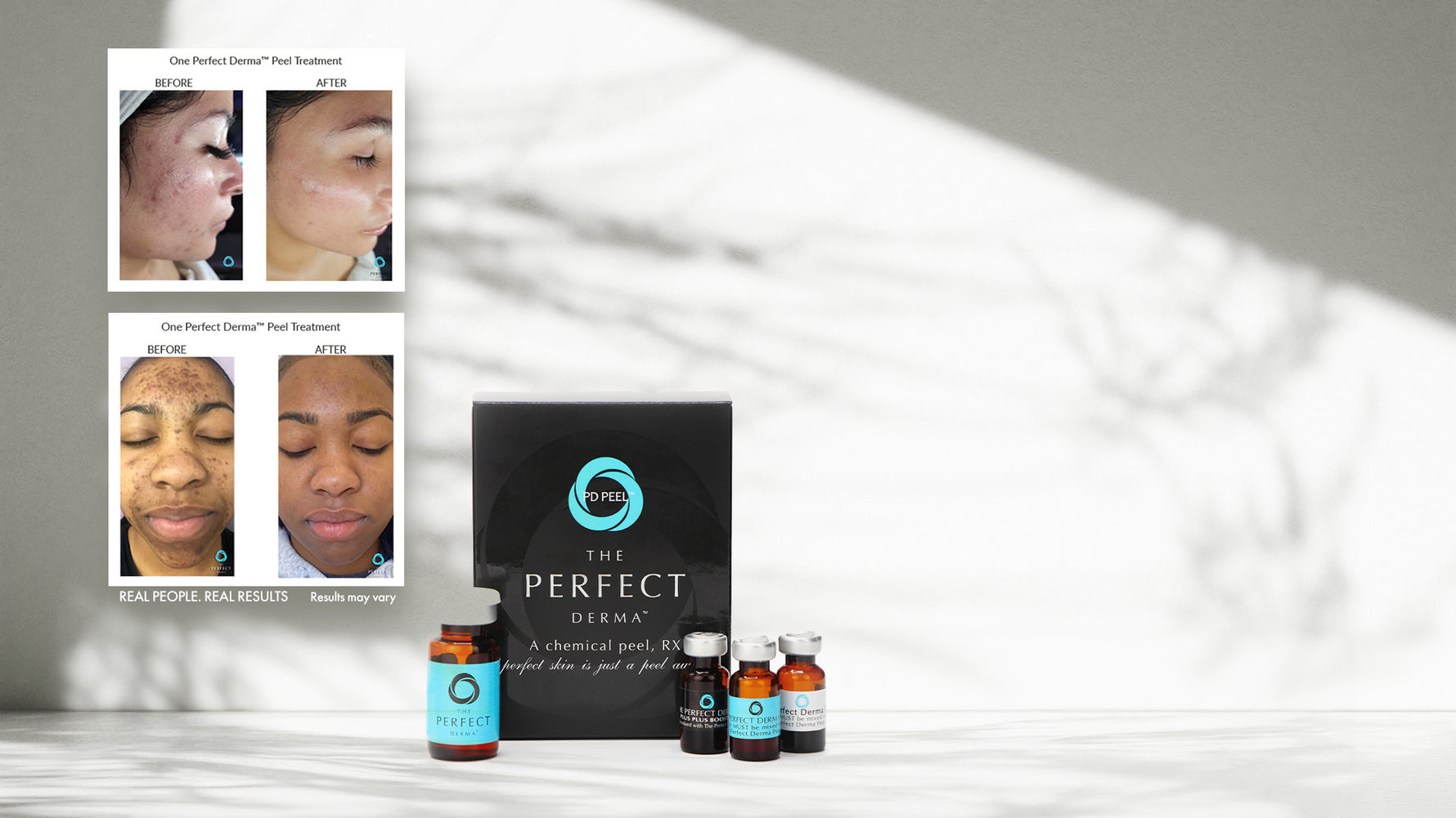 The Perfect Derma Peel | Perfect skin can be yours