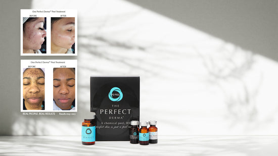 The Perfect Derma Peel | Perfect skin can be yours